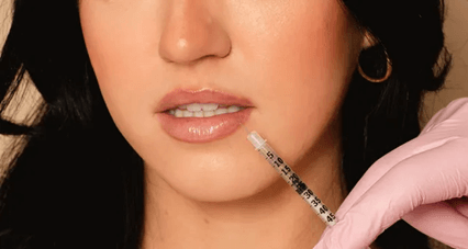 Dermal Fillers: LUSCIOUS LIP PLUSH FILLER PACKAGE | Doctor Edges
